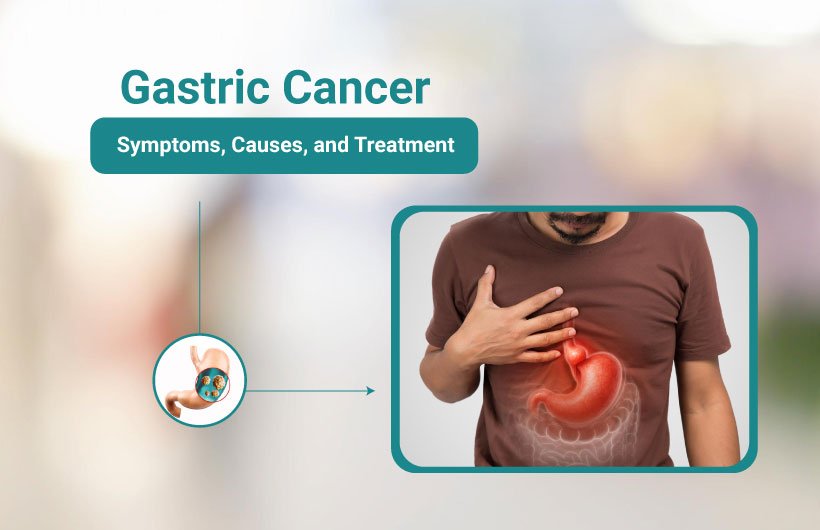 Best Oncologist in Ranchi | Medical Oncologist - Dr. Satish Sharma